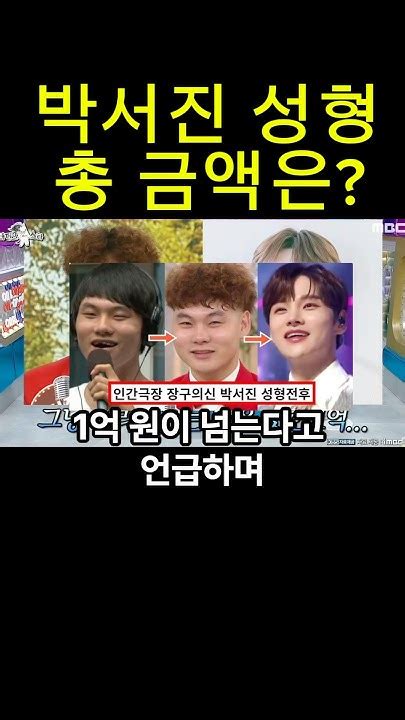 박서진 성형금액 공개 Youtube
