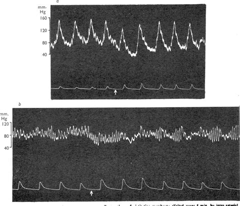 Figure 3 From The Peripheral Action Of Hexamethonium And Of Pentolinium
