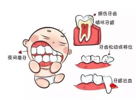 小孩子夜间磨牙严重是在长身体？ 知乎