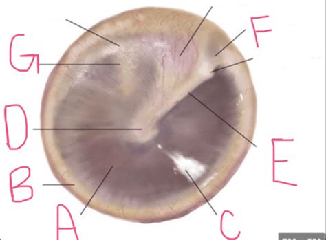 Hearing And Sound Anatomy Tympanic Membrane Flashcards Quizlet