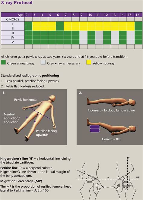 X Ray Protocol Template At Bailey Walters Blog