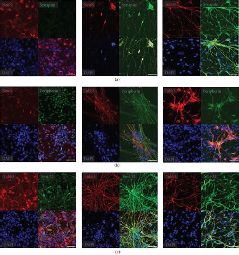 Expression Of Synapsin 1 Peripherin And Smi 32 Indicate Neuronal