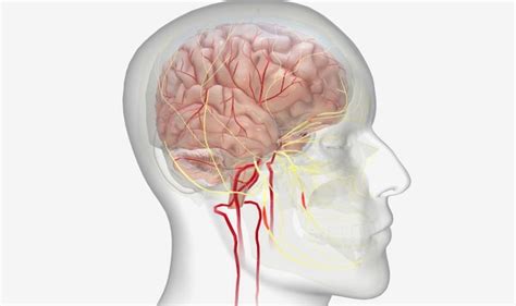 Premium Photo Migraine With Aura Is Caused By A Reduced Supply Of Oxygen To Ce
