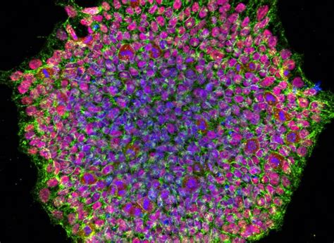 Justin Duplantis On Linkedin Immune Synchronization