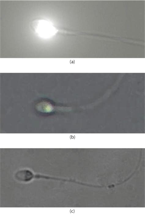 Evaluation Of Sperm Birefringence