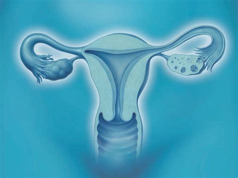 Recommendations Updated For Radiation Therapy In Endometrial Cancer