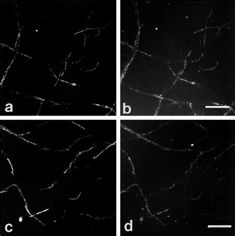 Immunocytochemical Colocalization Of Cell Surface Pp And 1 Integrin In Download Scientific