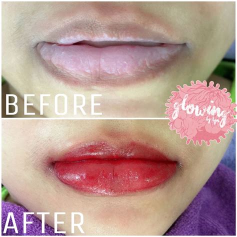 Pin Oleh Penikmat Senja Di Sulam Bibir Bibir Sulam Alis Sulaman