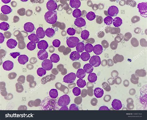 B Cell Microscope