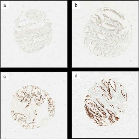 Original Ihc Images Corresponding To Different Scores A Negative