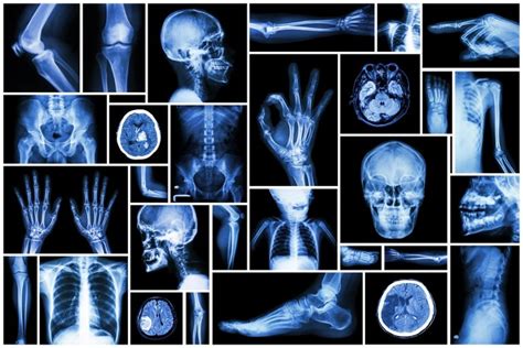 The Unreasonable Usefulness Of Deep Learning In Medical Image Datasets