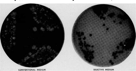 Figure 1 From A Selective Medium For The Cultivation Of N Gonorrhoeae