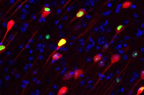 Brain Circuit Necessary For Memory Formation Identified Neuroscience News