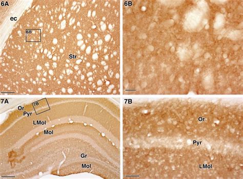 Synuclein Immunoreactivity In The Rat Striatum Using The Syn 1 Download Scientific Diagram