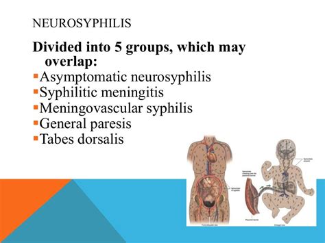 Syphilis Ppt