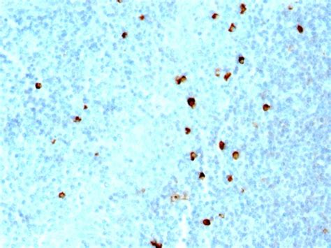Igm Immunoglobulin Mu Heavy Chain B Cell Marker Monoclonal Antibody