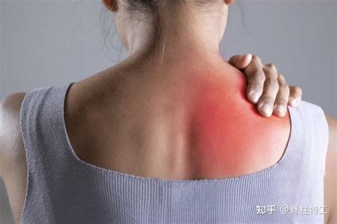 实录 肩胛骨缝疼，忍了10年，终于解脱了！ 知乎