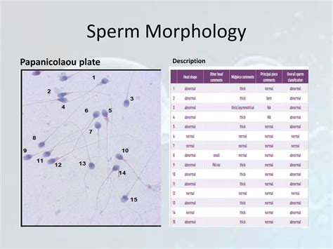 Who 6th Edition Update For Semen Analysis Pptx