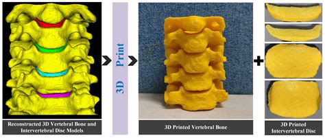 Cervical Intervertebral Disc Segmentation Based On Multi Scale Information Fusion And Its