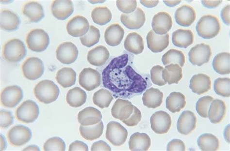 Basophils Overview Quantity Morphology Ivis