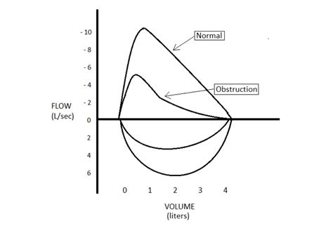 Top 5 Spirometry Tips For Copd Diagnosis And Management Respiratory Therapy Top 5 Spirometry Tips For Copd Diagnosis And Management Respiratory Therapy