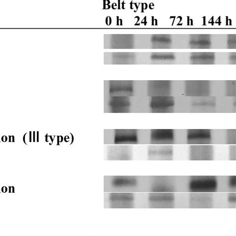 four types of expression patterns of tdfs in response to seed aging in