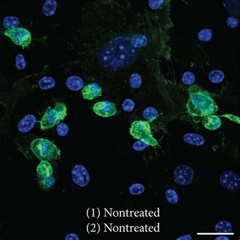 β Catenin Expression Within Mscs Cultures Mscs Were Immunostained For