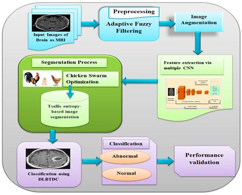 Electronics Free Full Text Handcrafted Deep Feature Based Brain Tumor Detection And