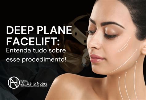 Deep Plane Facelift Entenda tudo sobre esse procedimento Dr Hélio Nobre