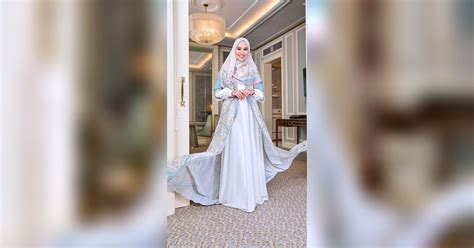 Terungkap Penyebab Wajah Kartika Putri Melepuh Dan Ruam Id