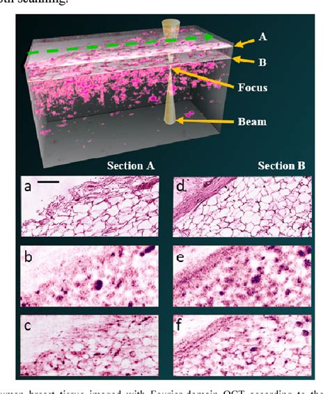 Figure 1 From Computational Optical Coherence Tomography [invited] Semantic Scholar