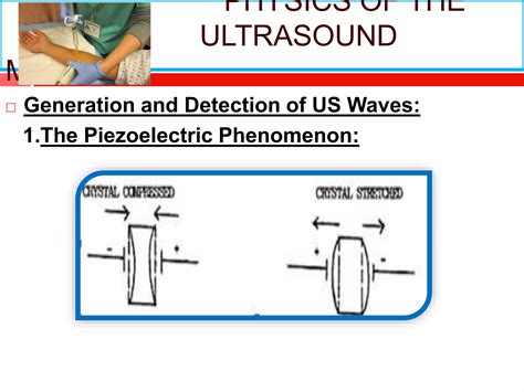Ultrasound Guided Upper Limb Nerve Block Pptx