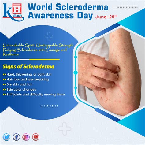 Kailash Healthcare Ltd On Linkedin Scleroderma Sclerodermaawareness Skindisease