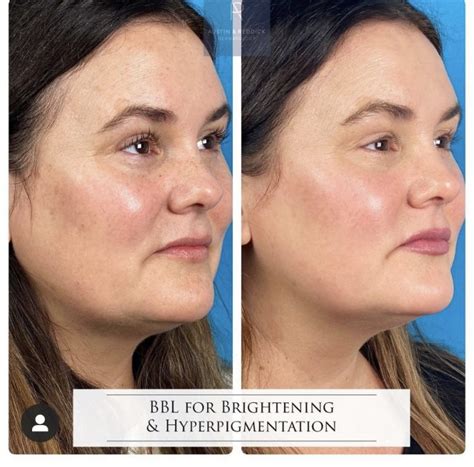 Home Austin And Reddick Dermatology