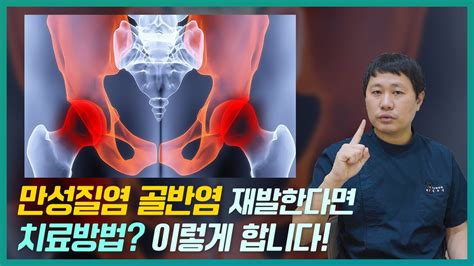 만성질염 골반염이 재발될 때 치료하는 방법은 YouTube