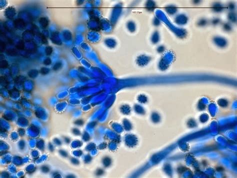 Fun With Microbiology Whats Buggin You Eurotium Herbariorum