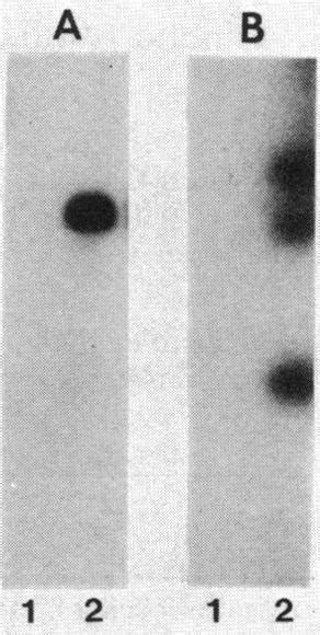 Autoradiogram Of 32p Labeled Xtns Hybridized To Digested Total Dna