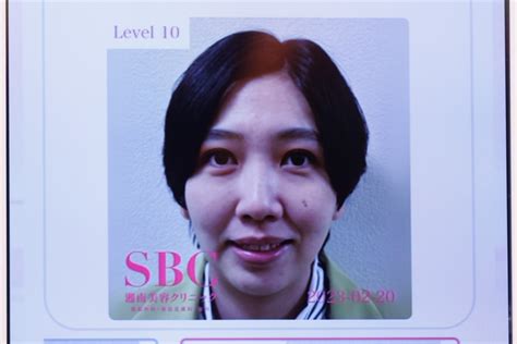 （写真）ゆりやんレトリィバァ、セルフ二重術は「10秒もたない」 エンタメ ニュース ｜クランクイン！