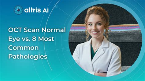 Our Blog Artificial Intelligence For Oct Interpretation