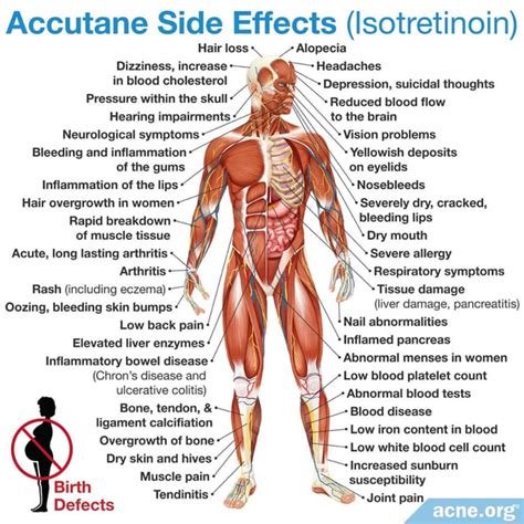 Mark Zauss Accutane Isotretinoin Adverse Psychiatric Effects Mark