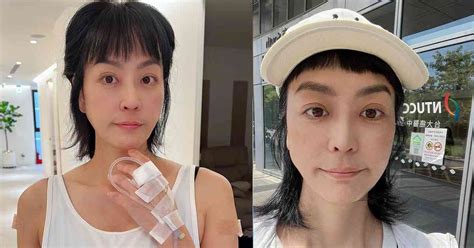 台灣女星唐玲胃癌4期抗癌5年！做8次化療、切23胃部、子宮、卵巢保命積極面對！即睇胃癌症狀原因！注意幽門螺旋桿菌感染 健康解「迷