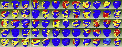 The Display Of ‘‘normalized Microregional Contractile Function By Download Scientific