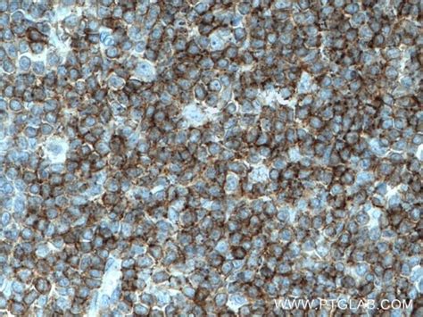 LCK Mouse anti Human Porcine Rat Clone D C Proteintech μL Fisher Scientific