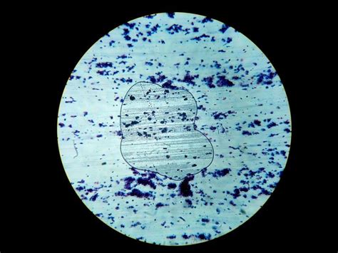 A Histological Slide Of A Tissue Sample Close Microscopic View