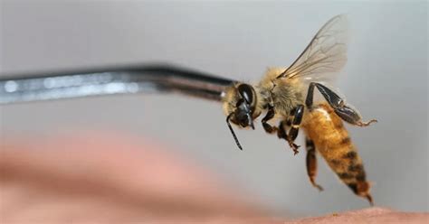 Woman Dies After Receiving Live Bee Sting Acupuncture Jesus Daily