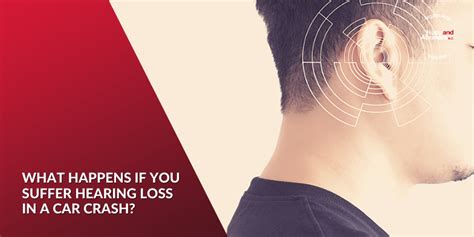 Car Accident Tinnitus And Hearing Loss Injuries Hupy And Abraham Sc