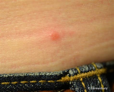Time For Ticks Lone Star Tick Amblyomma Americanum Blacklegged