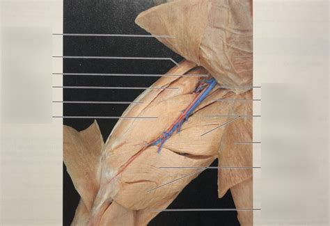 D12b Thigh Of Cat Diagram Quizlet