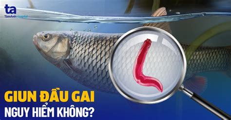 Giun Chỉ Hình ảnh đặc điểm Cấu Tạo Và Chu Kỳ Sinh Trưởng