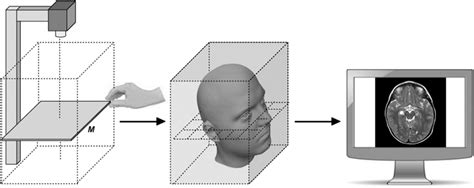 A Medical Application Based On Planar Pose Estimation On A Low Cost